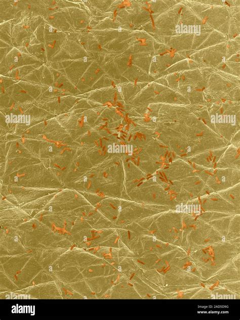 Coloured Scanning Electron Micrograph Sem Of Photocomposite E Coli On The Surface Of Human