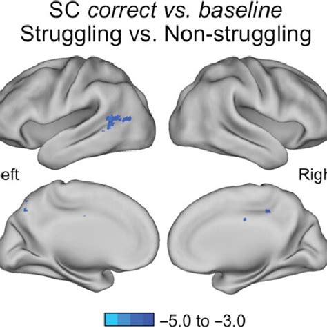 group comparison for sc task correct versus baseline z score