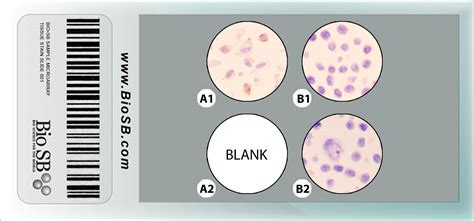 3 Core Gist Cell Line Microarray Bio Sb