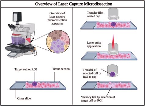 Overview Of Laser Capture Microdissection Download Scientific Diagram