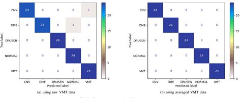 Figure 2 From Automated Classification Of Vmt Pathology From Optical Coherence Tomography B