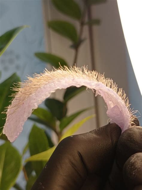 Ingrown Pubic Hair Treatment Prevention And More Artofit