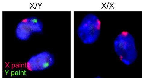 9 3 Sex Linked Genes Biology Libretexts
