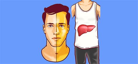 အသည်းရောဂါဖြစ်ပွားနေပြီဆိုတဲ့ လက္ခဏာများ