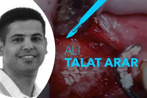 Sinus Floor And Bone Defect Augmentation Following Cystectomy Using Cerabone® Surgery