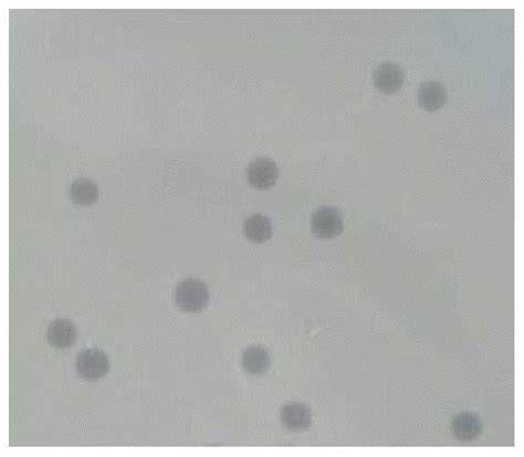 一株高效裂解碳青霉烯耐药肺炎克雷伯菌噬菌体及其应用 2