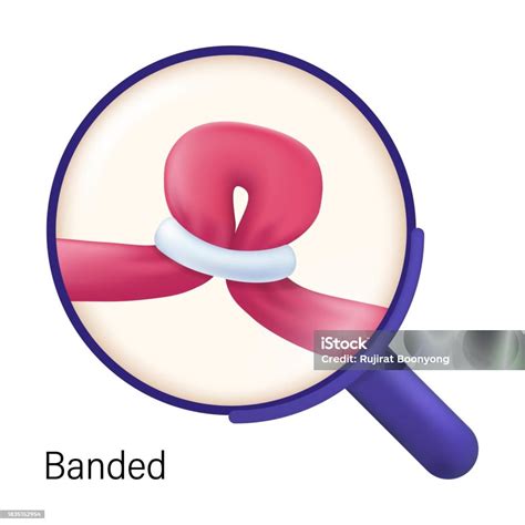 Banded Method Of Female Sterilization Tubal Ligation Vector The