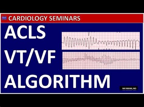 ベスト Vf Vt Ekg 167687 Ekg Vf Vt คอ