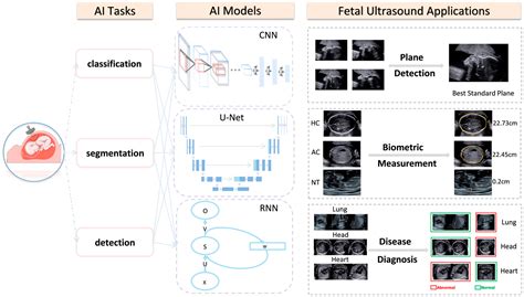 Application And Progress Of Artificial Intelligence In Fetal Ultrasound