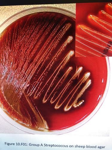 Streptococci Flashcards Quizlet
