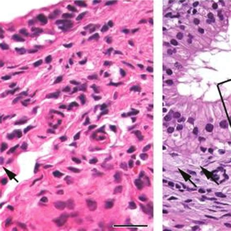 Electron Microscopy Of Vaginal Tissue Of A B6129s6 Naglu Tm1efn J