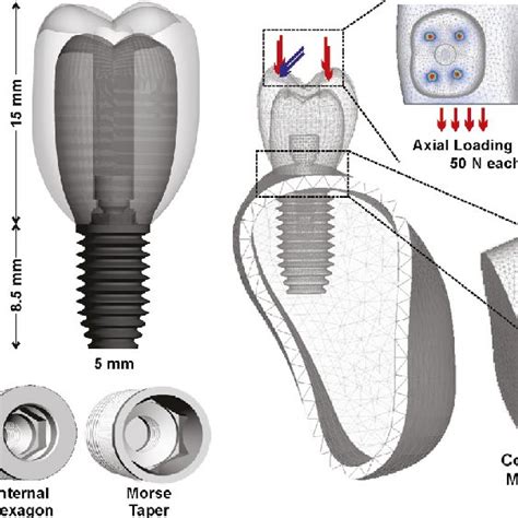 Pdf Three Dimensional Finite Element Analysis Of Varying Diameter And Connection Type In