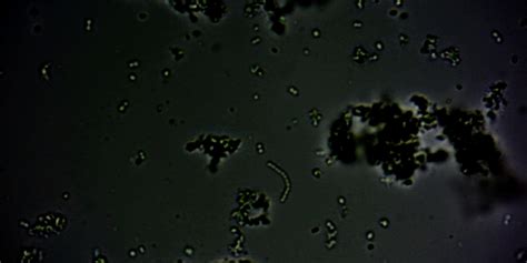 Lactobacillus Bulgaricus And Streptococcus Thermophilus Biological