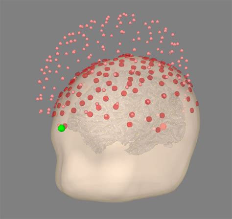 Subject Mne Viz Plot Alignment Not Displaying Electrodes Support