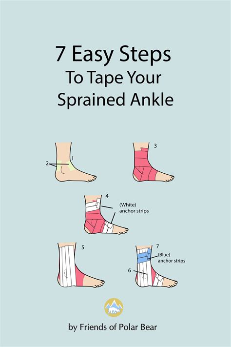 7 Easy Steps To Tape Your Sprained Ankle Sprained Ankle Ankle