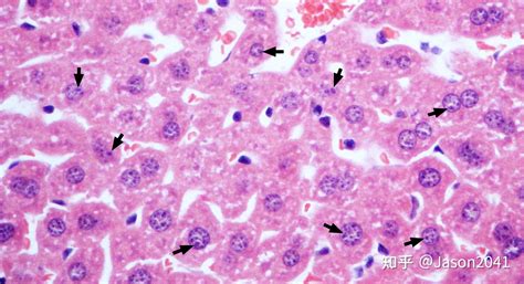 核仁在he染色切片上到底呈嗜碱性还是嗜酸性？ 知乎