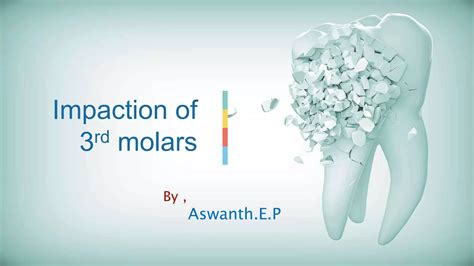 Impaction Of Mandibular 3rd Molar Pptx