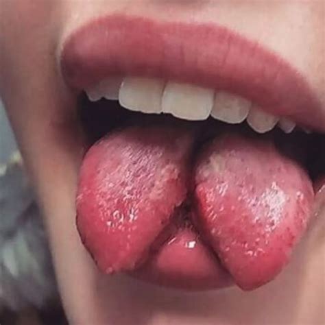 Split Tongue Splitting