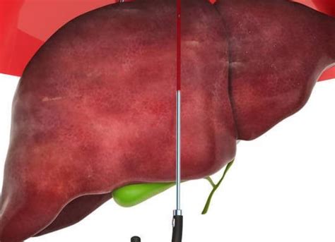 什么是乙肝携带者！乙肝病毒携带者会遗传给宝宝吗？ 12健康