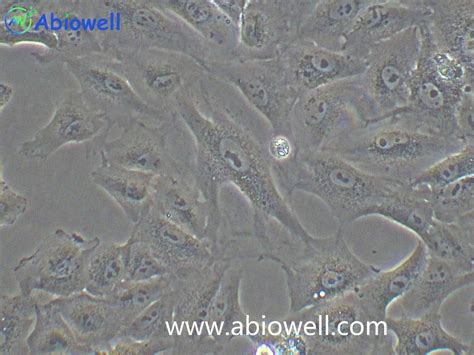A549 人非小细胞肺癌细胞 （str鉴定） 艾碧维生物官网