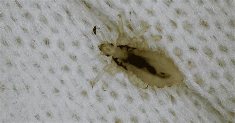 Lice Vs Flea Comparison Friendly Guide To Pest Differences
