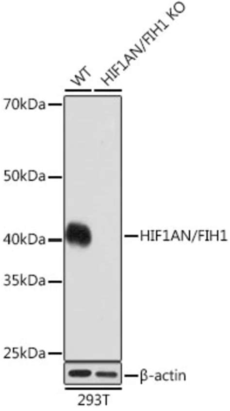 Invitrogen Hif1an Recombinant Rabbit Monoclonal Antibody 9r7v4 100 μl