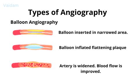 Angiography Cost In Cape Town Updated 2024