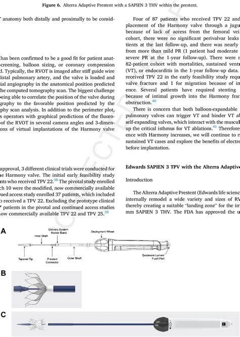 A Schematic Diagram Showing The Alterra Prestent Delivery System Download Scientific Diagram
