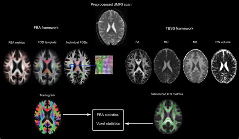 Overview Of Key Processing Steps Of Dmri Scans Preprocessed Dmri Data