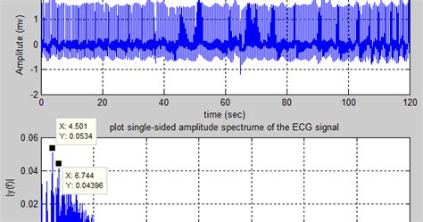 Biomedical Signal And Image Processing Projects Using Matlab And Labview Tools Matlab Code To