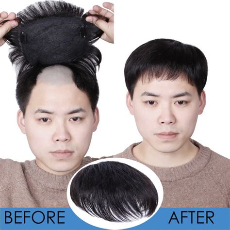 Jual Toupee Penutup Botak Cowok Pria Laki Laki 012 Rsw Real Human