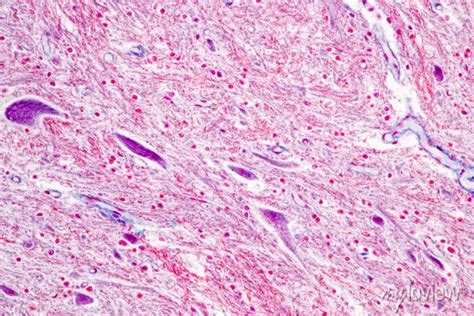 Education Spinal Cord Nerve Cerebellum Cortex And Motor Neuron