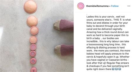 This Is What A Cervix Looks Like And Its Incredible