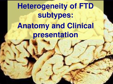 Ppt Frontotemporal Dementia Ftd Powerpoint Presentation Free