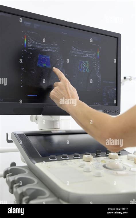 Ultrasonic Examination Of Internal Organs A Man On An Abdominal Ultrasound Scan Apparatus For