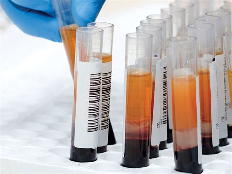 Leveraging The Full Potential Of Sensitive Circulating Tumor Dna Analyses Inside Precision