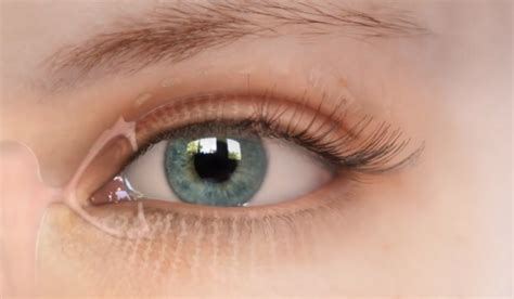 Dry Eye Testing Video Fort Lauderdale Eye Institute