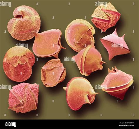 Dinoflagellates Under Electron Microscope
