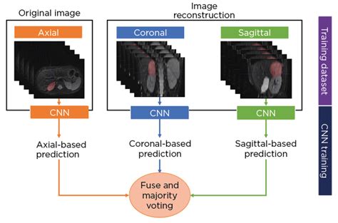 Fully Automated Segmentation Of Neuroblastic Tumours On Multisequence Mri Using Convolutional