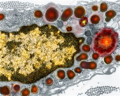 Mast Cell Tem Stock Image C0610562 Science Photo Library