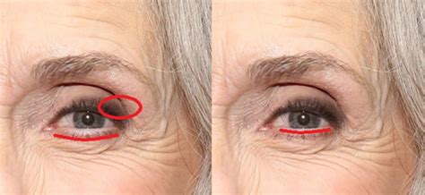 უფროსი ასაკის ქალბატონებო რატომ უსვამთ ხაზს თვალების დაბინდულობას სიმკრთალეს და ასაკოვან