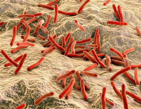 Genetic Analysis Shows Leprosy Was Endemic In Pre Colonial America