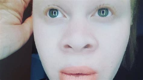 This Albino Womans Review Of Fenty Beautys Foundation Proves Just How Inclusive The Line Is