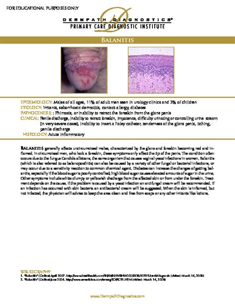 Balanitis Pdf Pdfcoffee Com