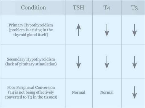 Hypothyroidism Evaluation And Management By Dr Selim Ppt Thyroid