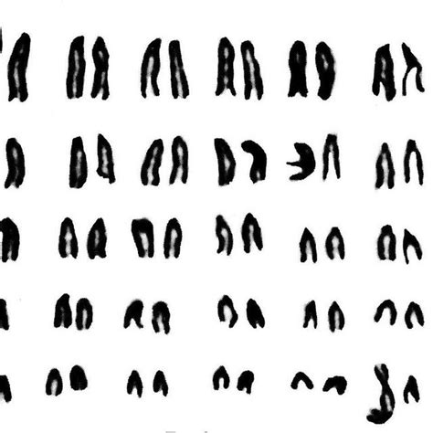 Pdf Y Chromosome Variants In Cattle Bos Taurus And Bos Indicus