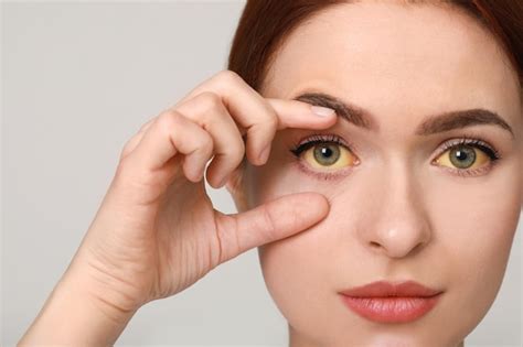 Premium Photo Woman With Yellow Eyes On Light Grey Background Symptom