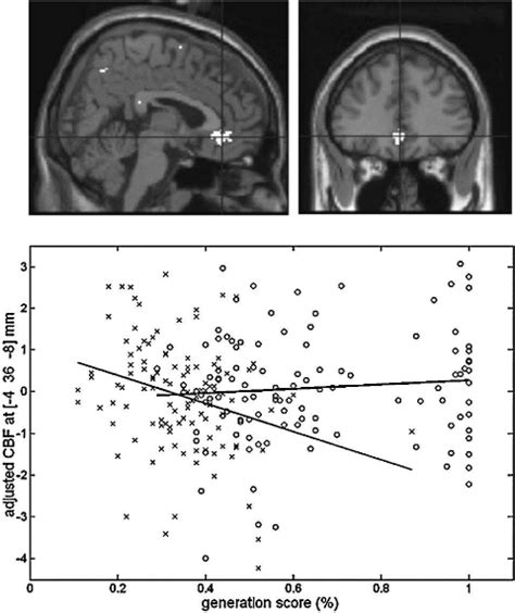Neural Correlates Of Conscious Sequence Learning Top Panel
