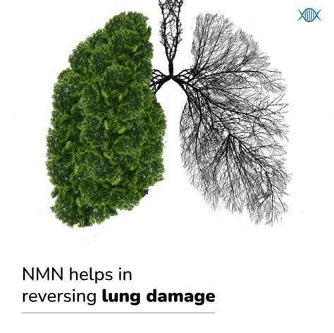 Decode Age® On Linkedin Nmn Supplements