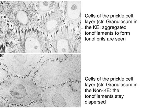 Ppt Oral Mucosa Powerpoint Presentation Id1094282